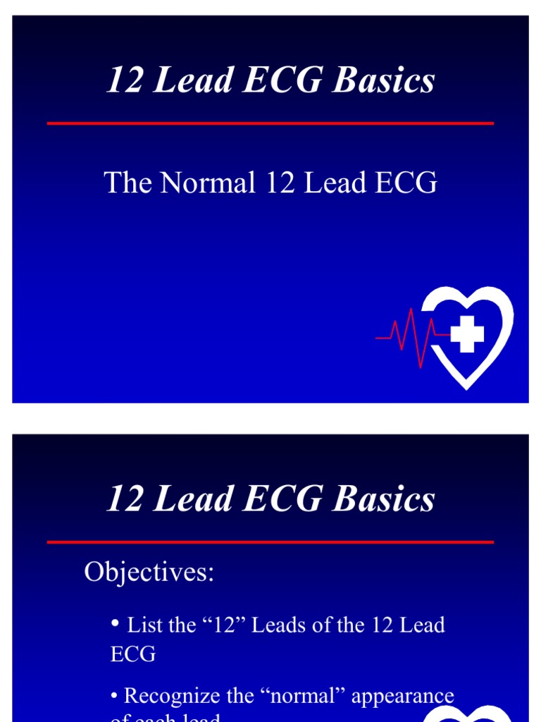 Lead Ekg Basics