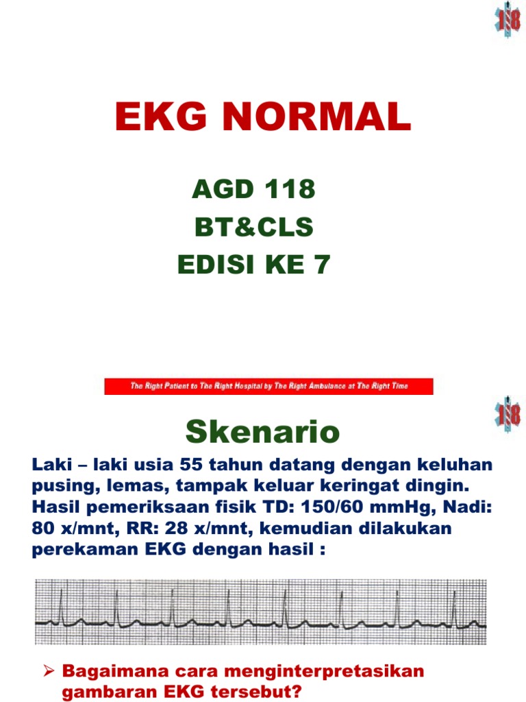 Ekg Normal: AGD 118 Bt&Cls Edisi Ke 7 | PDF