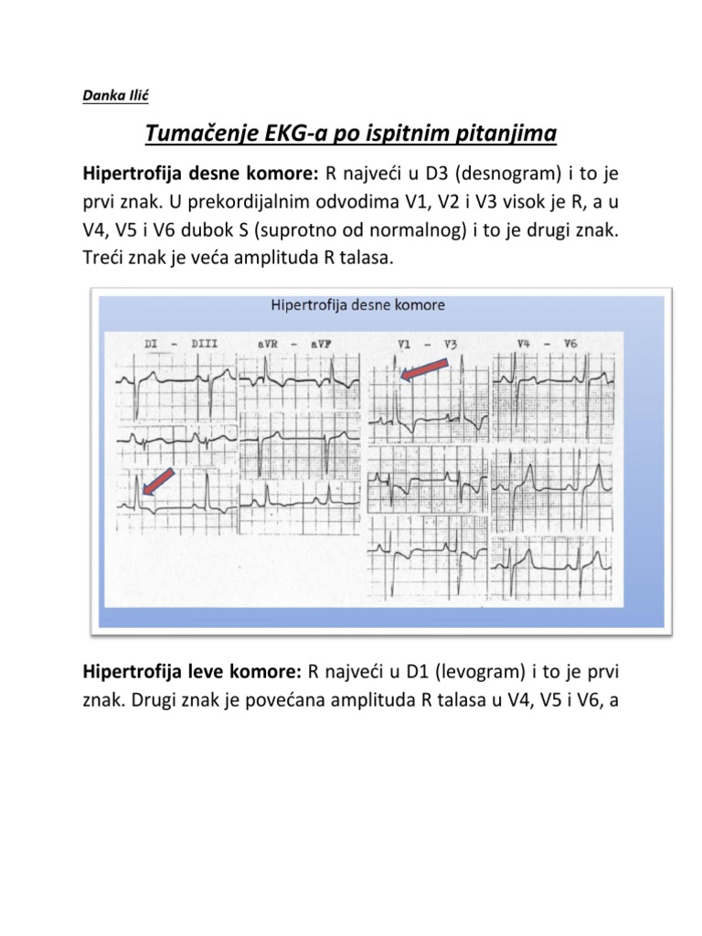 Patofiza Tumacenje EKG-a | PDF