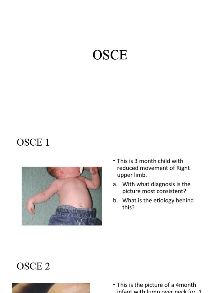 OSCE | PDF