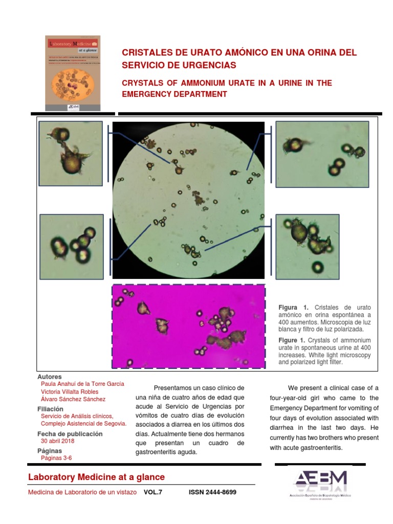 PLANTILLA PDF. Articulo 1 - Cristales Urato | PDF | Enfermedades y ...