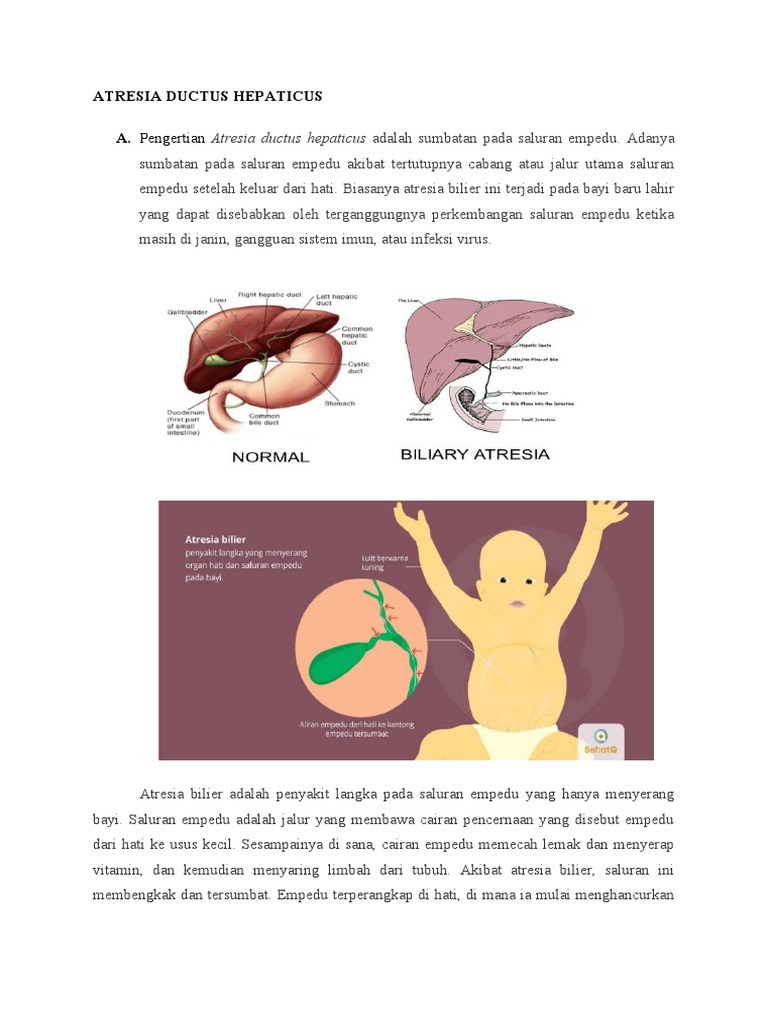 Materi Atresia Duktus Hepatikus | PDF