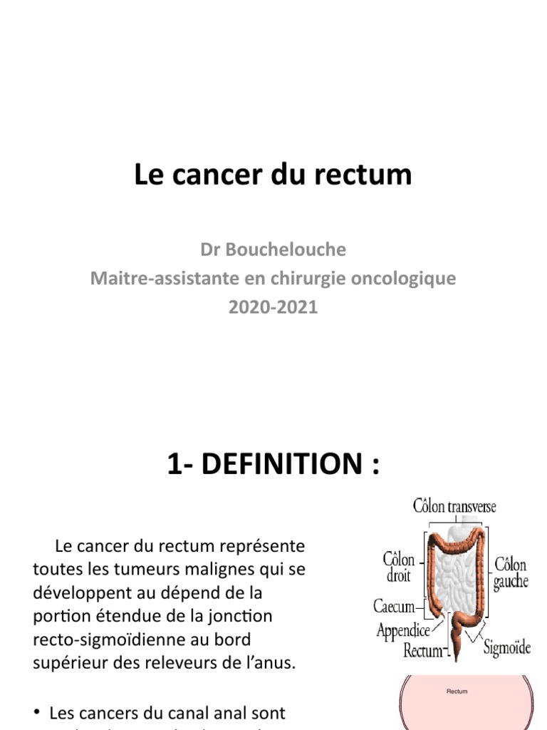 Cancer du rectum : définition et enjeux | PDF | Cancer du côlon | Cancer
