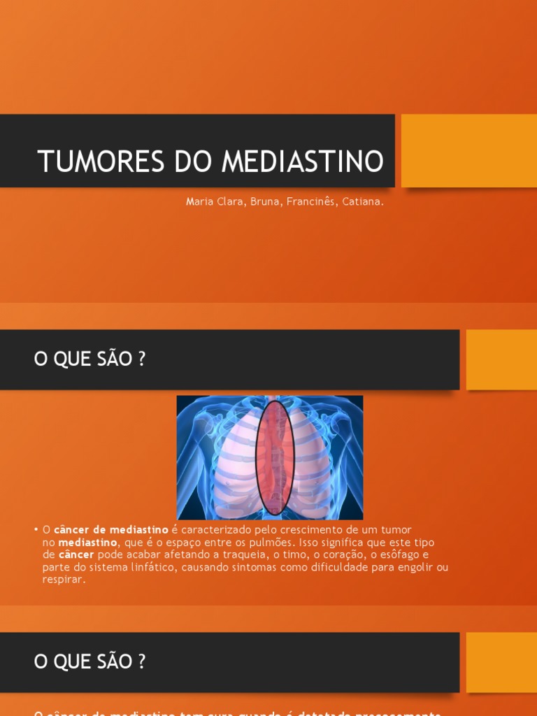 Tumores Do Mediastino | PDF | Câncer de pulmão | Câncer