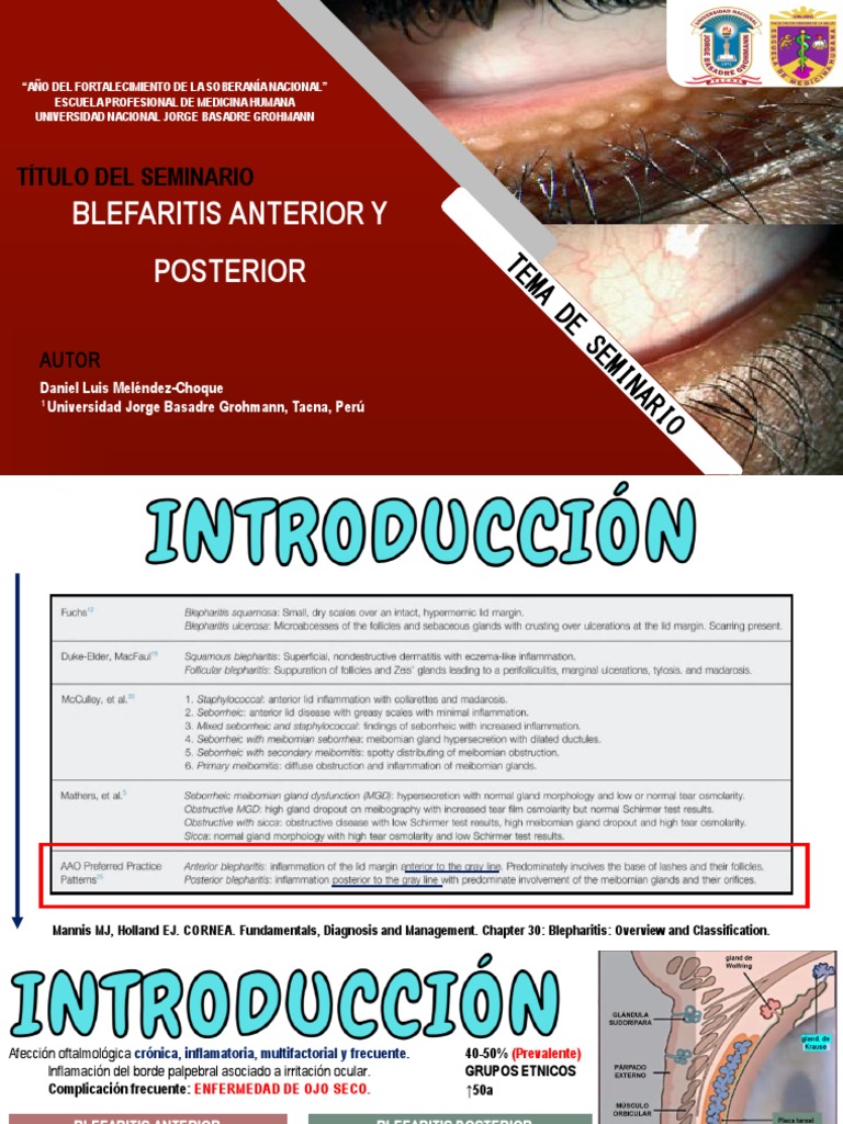 Guía Completa sobre Blefaritis Anterior y Posterior | PDF | Ojo humano ...