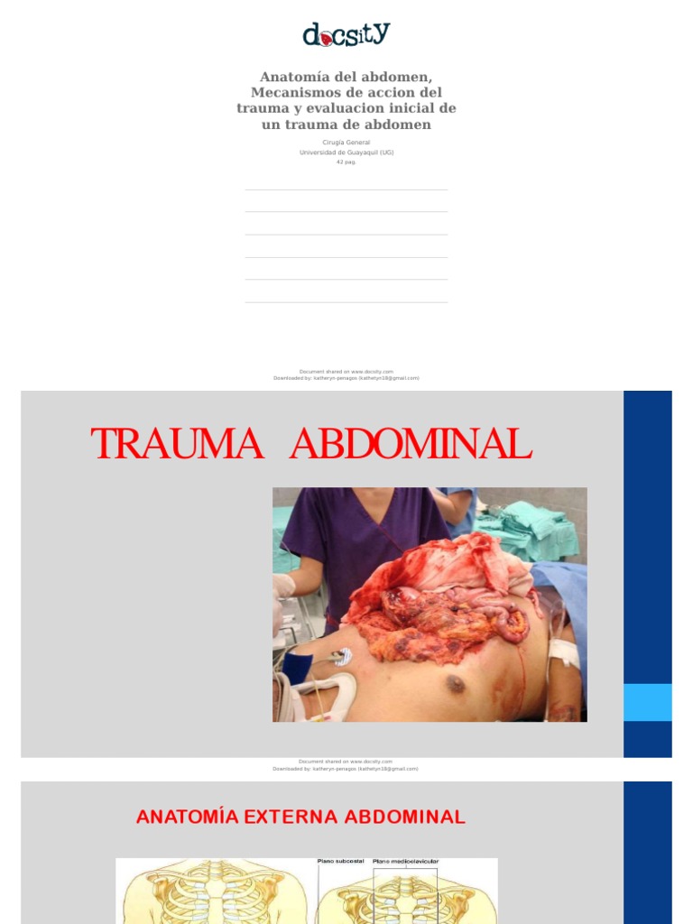 Docsity Anatomia Del Abdomen Mecanismos de Accion Del Trauma y Evaluacion Inicial de Un Trauma ...