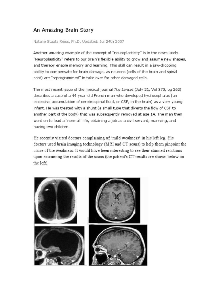 An Amazing Brain Story | PDF