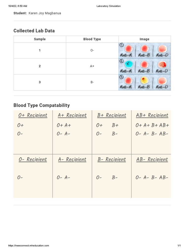 Activity 21 - Blood Typing | PDF