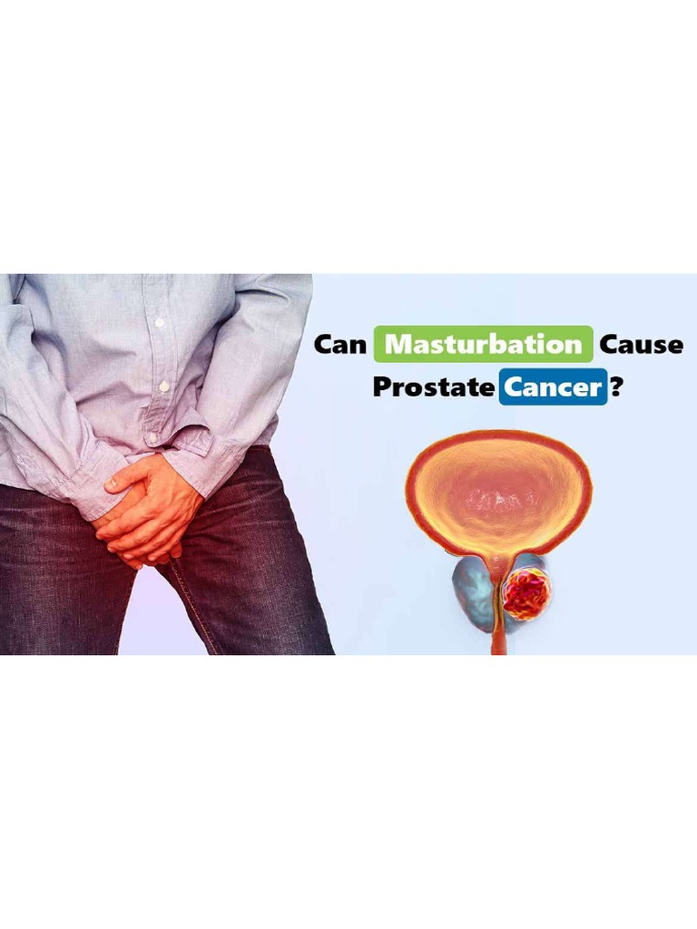 Can Masturbation Cause Prostate Cancer | PDF