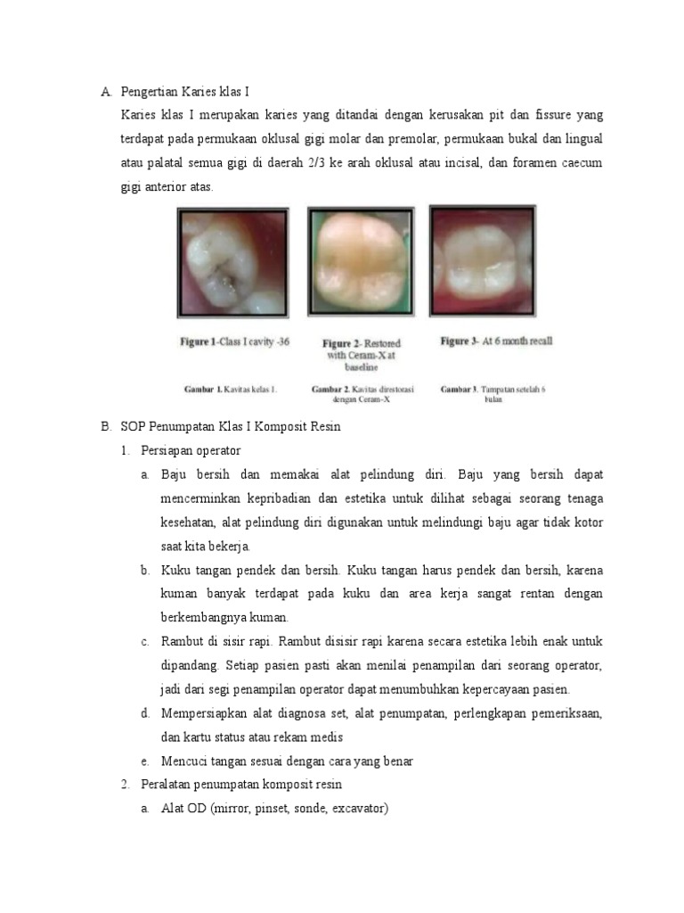 Bahan Makalah Penumpatan Komposit Resin | PDF