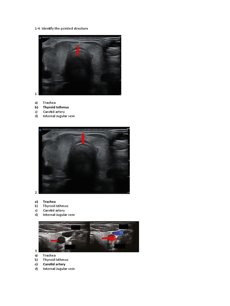 Thyroid Imaging Quiz Pdf