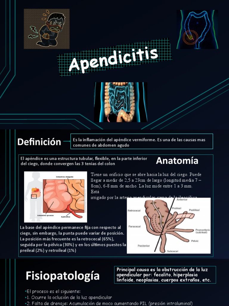Apendicitis: Causas, Síntomas y Tratamiento | PDF | Especialidades ...