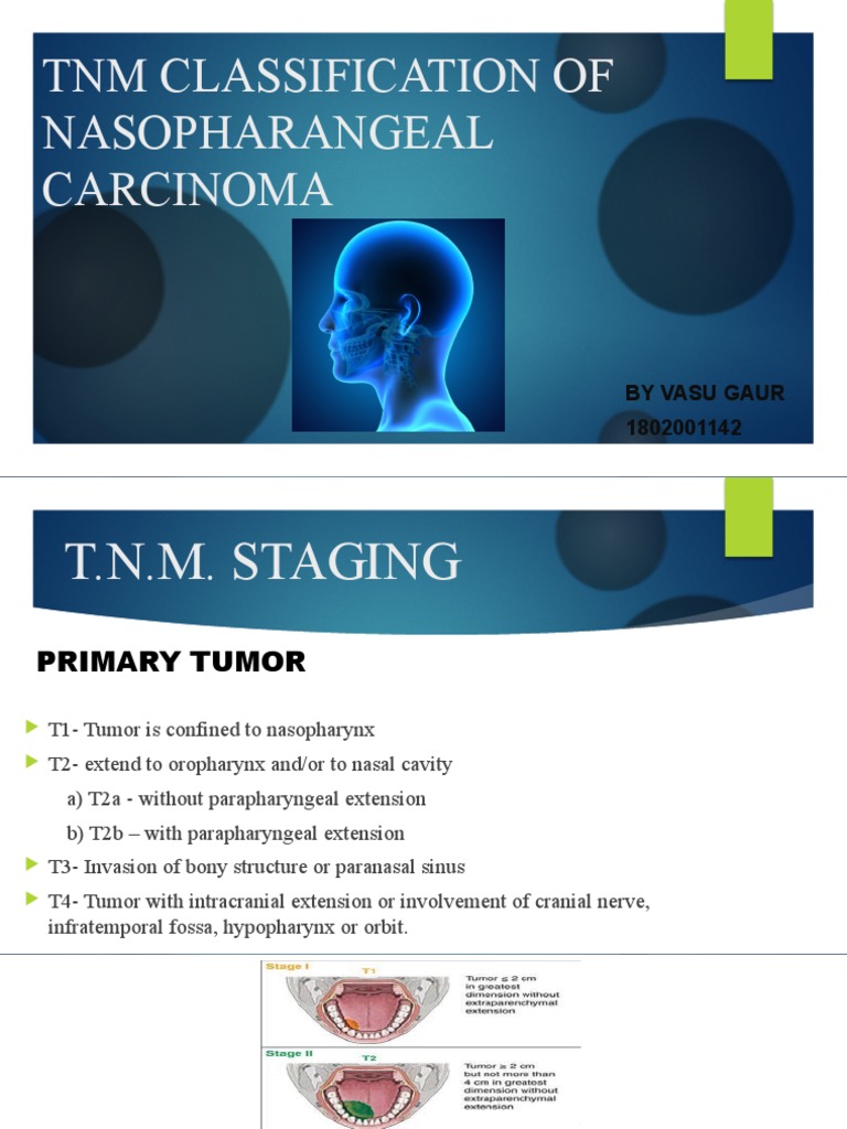 TNM Classification | PDF