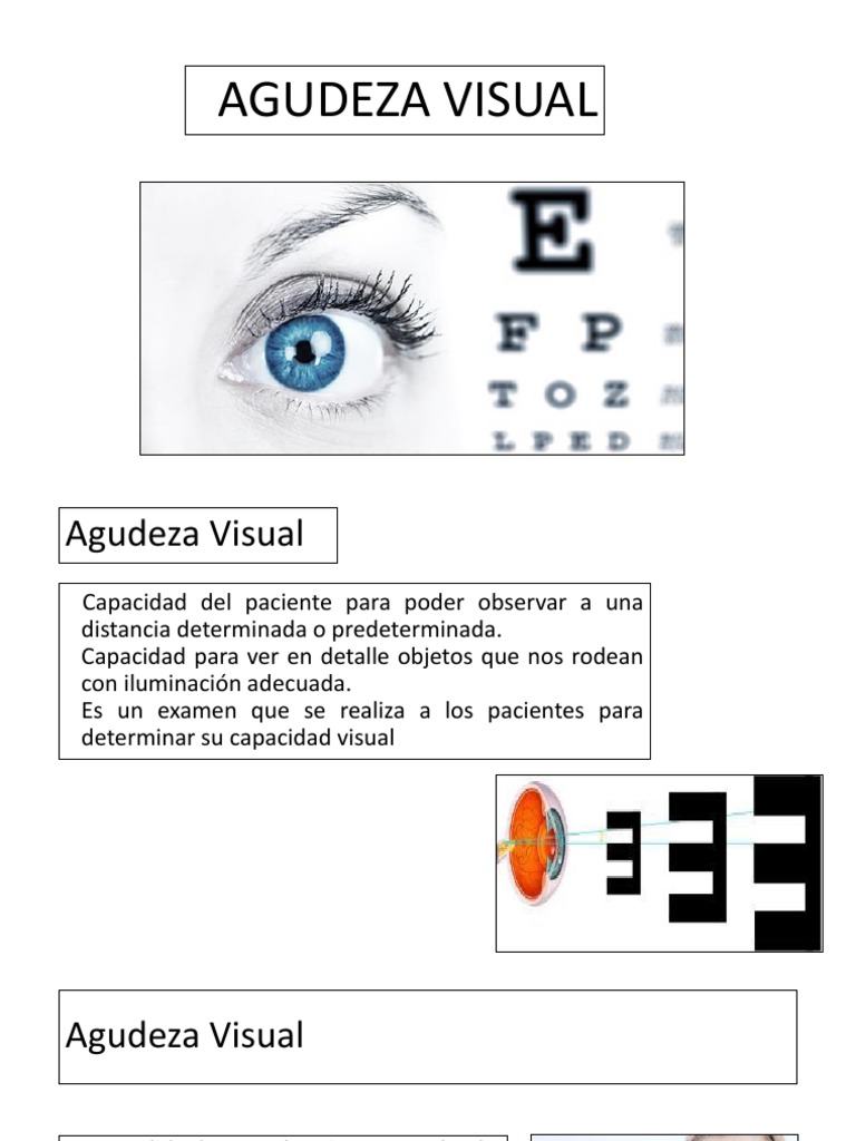 AGUDEZA VISUAL-exposicion | PDF | Percepción visual | Agudeza visual