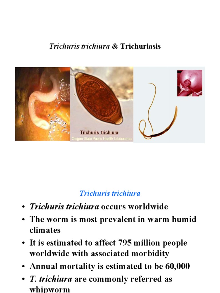 Trichuris Trichiura | Download Free PDF | Diseases And Disorders ...