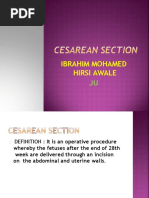 LSCS: Definition, Types, and Indications | PDF | Caesarean Section ...