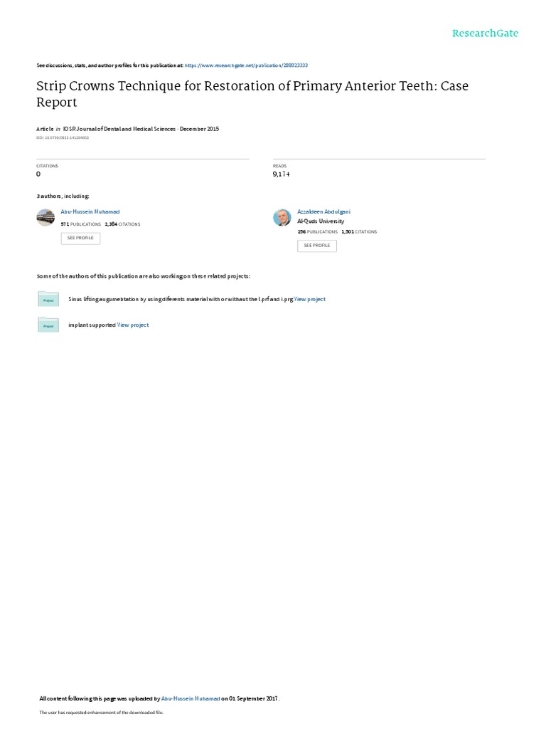 Strip Crowns Technique For Restoration of Primary Anterior Teeth: Case ...