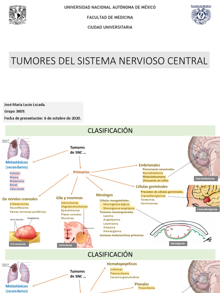 Tumores Del SNC | PDF | Sistema nervioso central | Cáncer