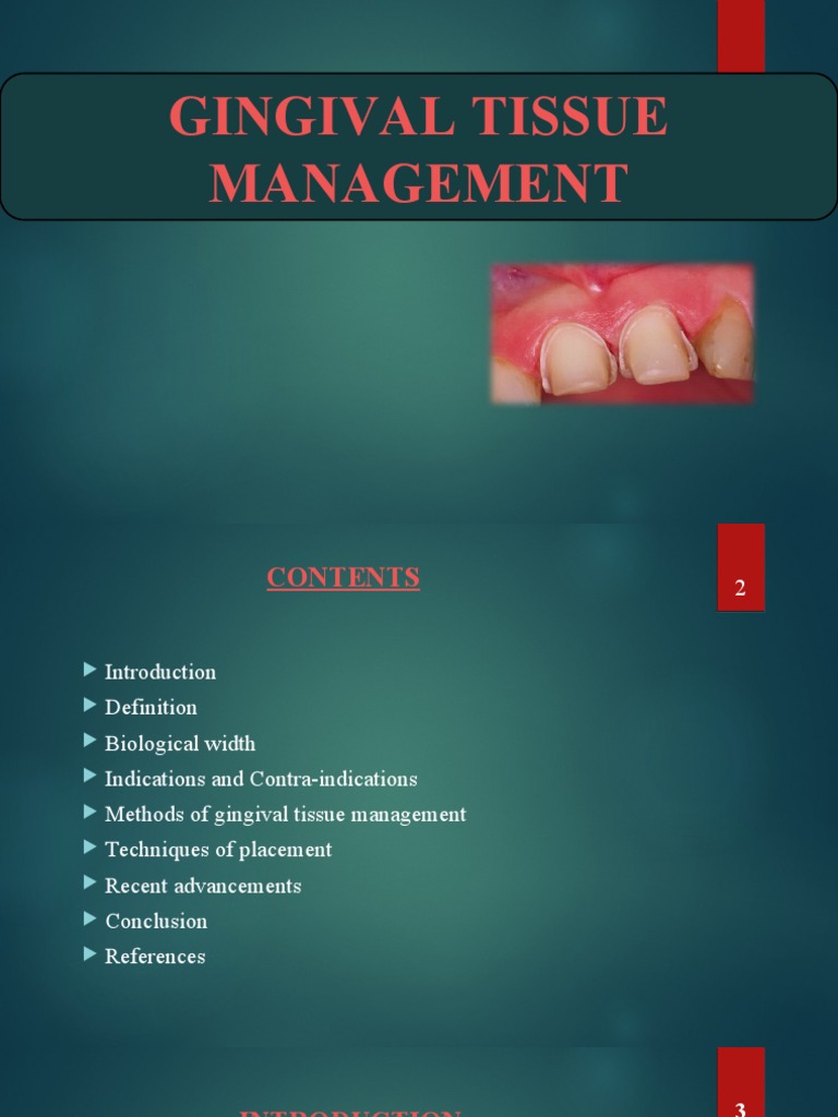 Gingival Tissue Management | PDF