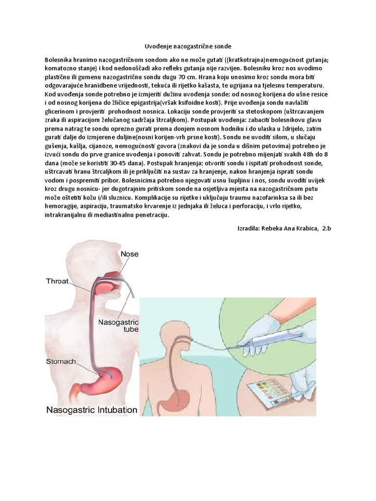 Uvođenje Nazogastrične Sonde | PDF