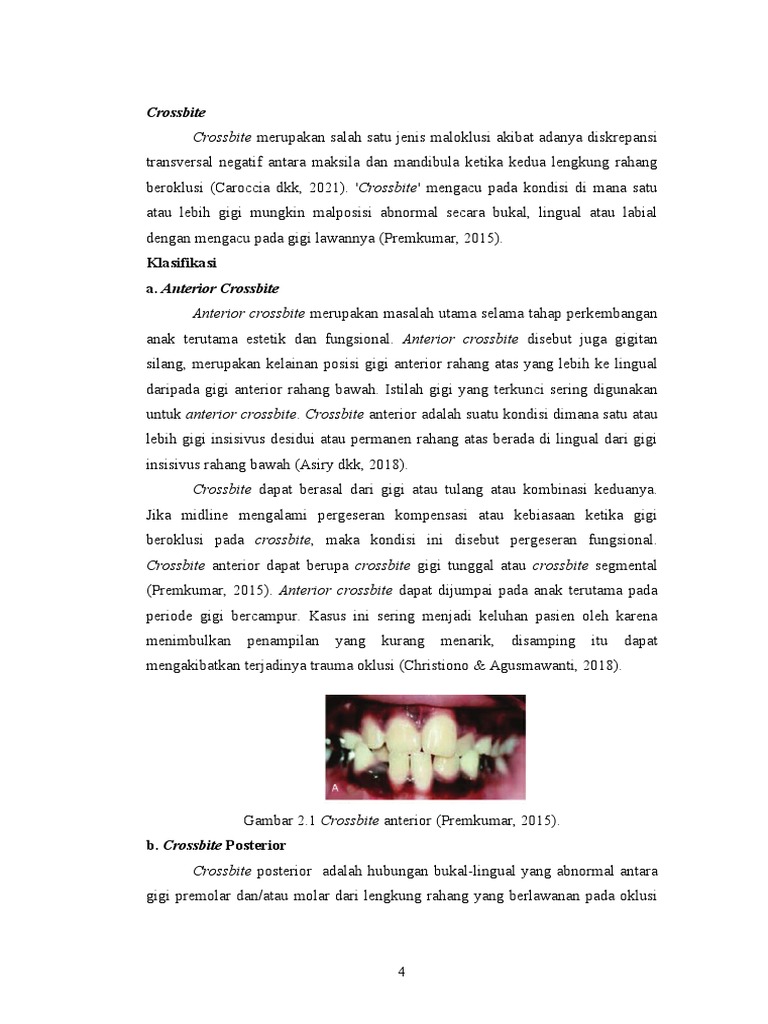 Jenis dan Klasifikasi Crossbite | PDF