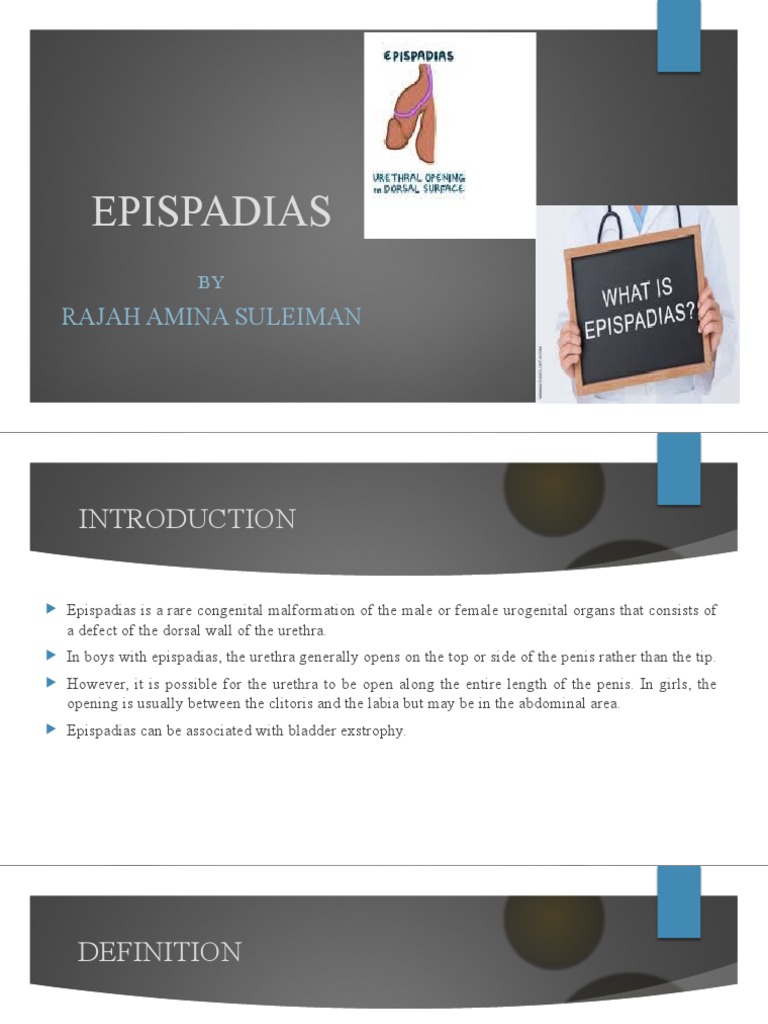 EPISPADIAS | PDF | Urinary System | Urinary Bladder