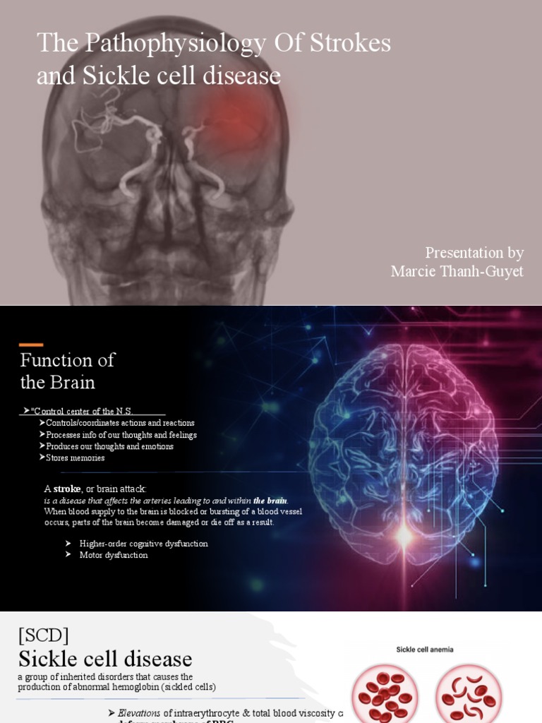 The Pathophysiology of Strokes and Sickle Cell Disease | PDF | Stroke | Ischemia