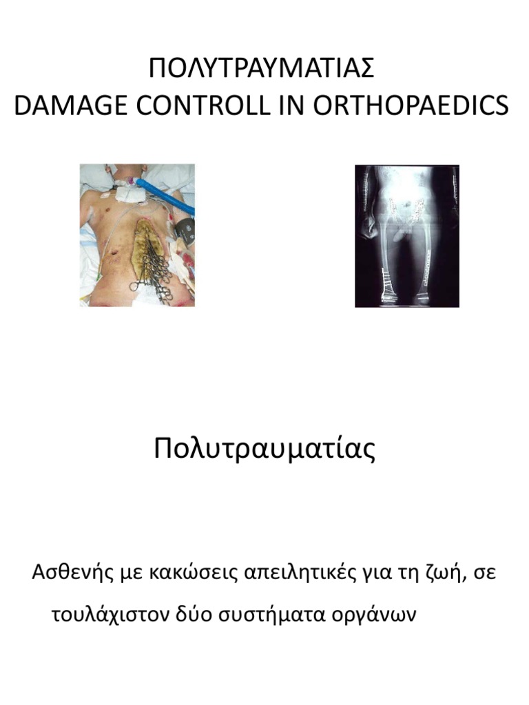 Damage Controll Orthopaedics | PDF