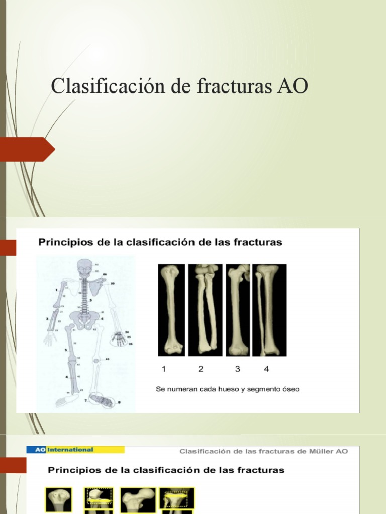 Clasificación De Fracturas Ao Pdf