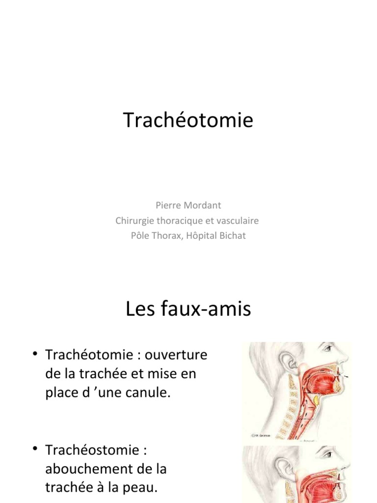 Prise en charge de la trachéotomie | PDF | Thorax | Causes de décès