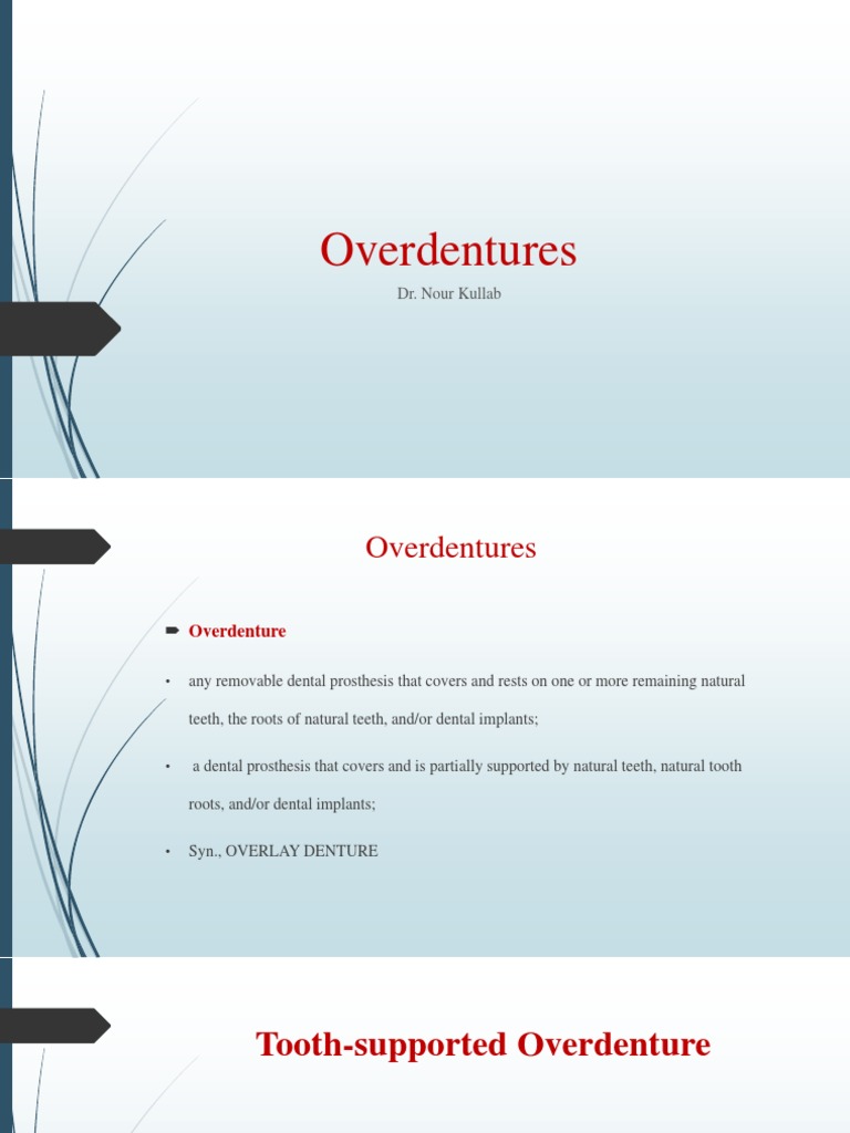 6 Overdenture | PDF | Dentures | Periodontology