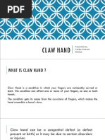 Hand of Benediction What Is It, Causes, and More Osmosis | PDF | Hand ...