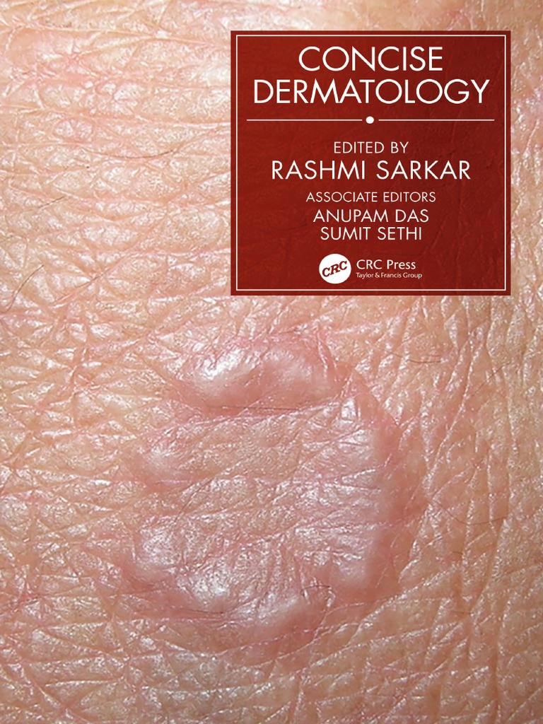 Concise Dermatology | PDF | Epidermis | Skin