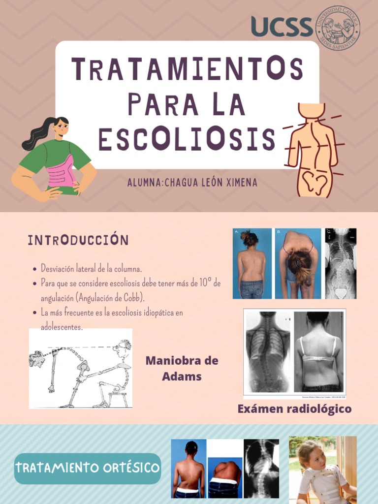 Tratamientos para Escoliosis Listo | PDF | Escoliosis | La columna ...