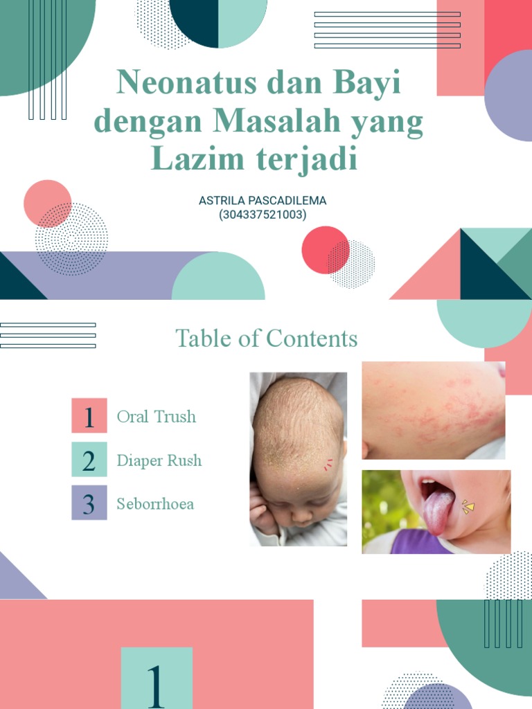 Masalah Lazim Yang Terjadi Pada Bayi (Oral Trush, Diaper Rush Dan ...