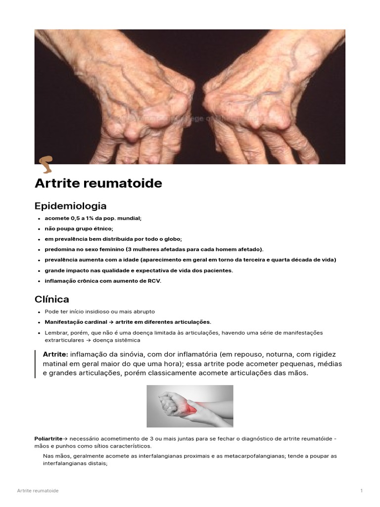 Artrite Reumatoide: Epidemiologia, Clínica, Diagnóstico e Tratamento ...