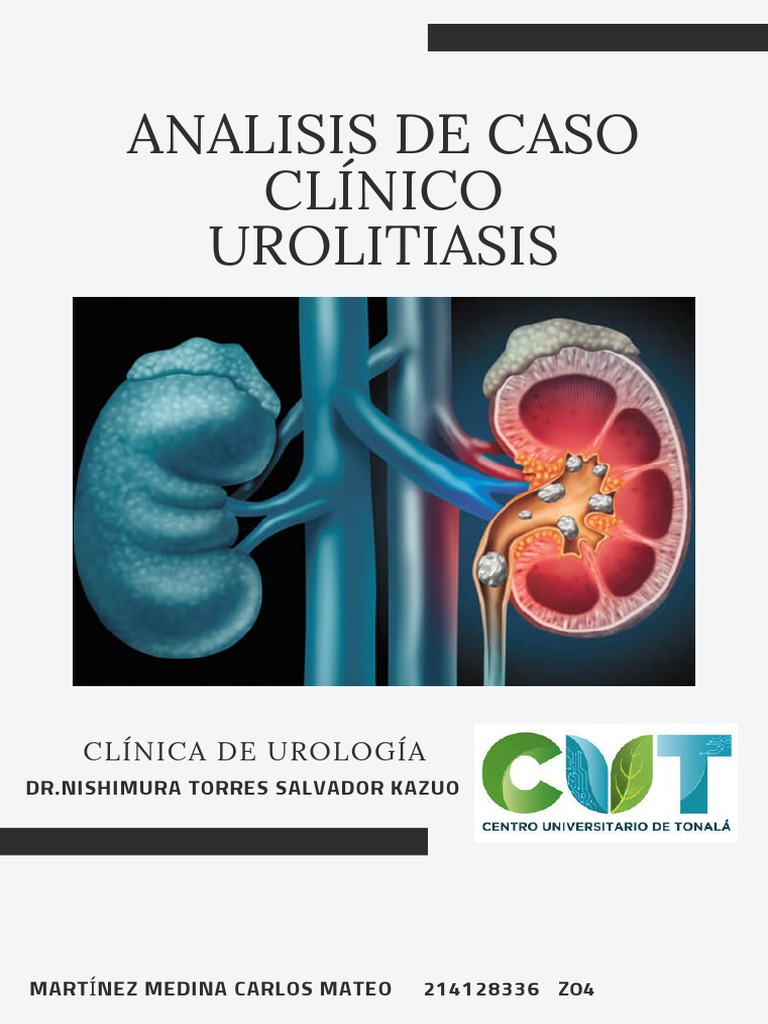 Copia de Análsis de Caso Clínico - Urolitiasis | PDF | Enfermedades y ...