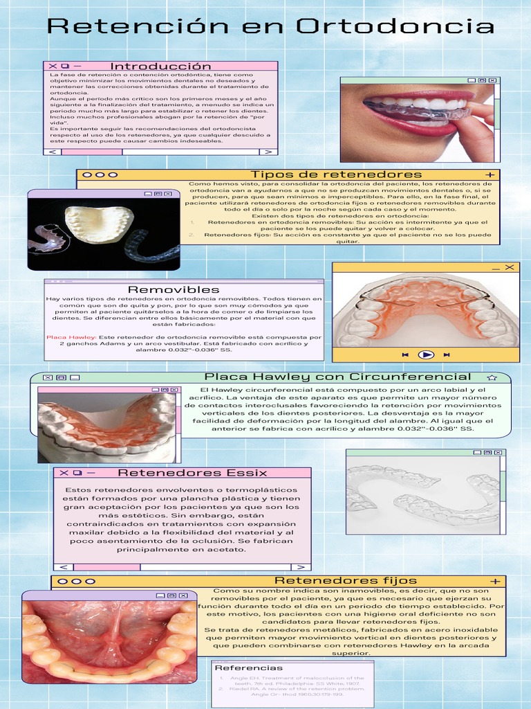 Infografia Retención | PDF | Ortodoncia | Ramas de Odontología