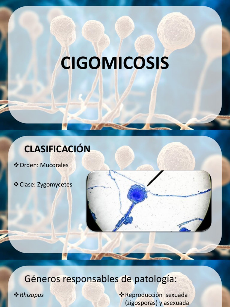Cigomicosis | PDF | Diabetes | Especialidades Medicas