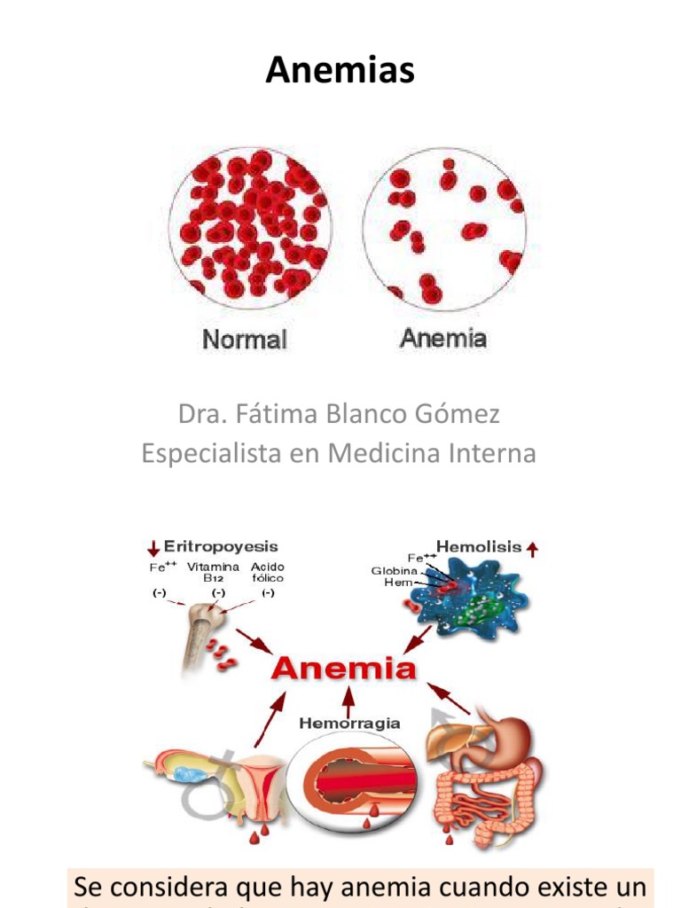 Anemias | PDF | Glóbulo rojo | Anemia