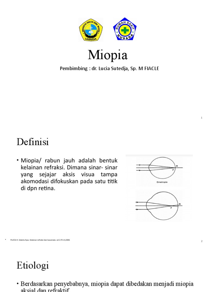 MIOPIA | PDF