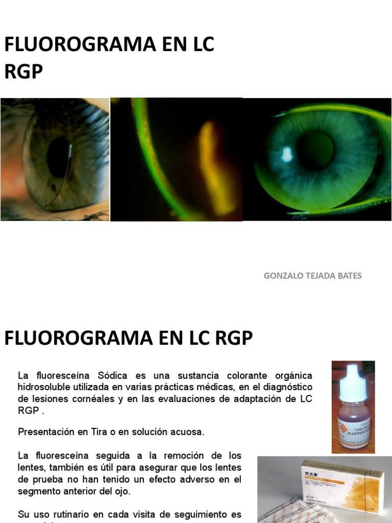 Lentes de Contacto RGP - Fluorograma | PDF | Córnea | Ojo