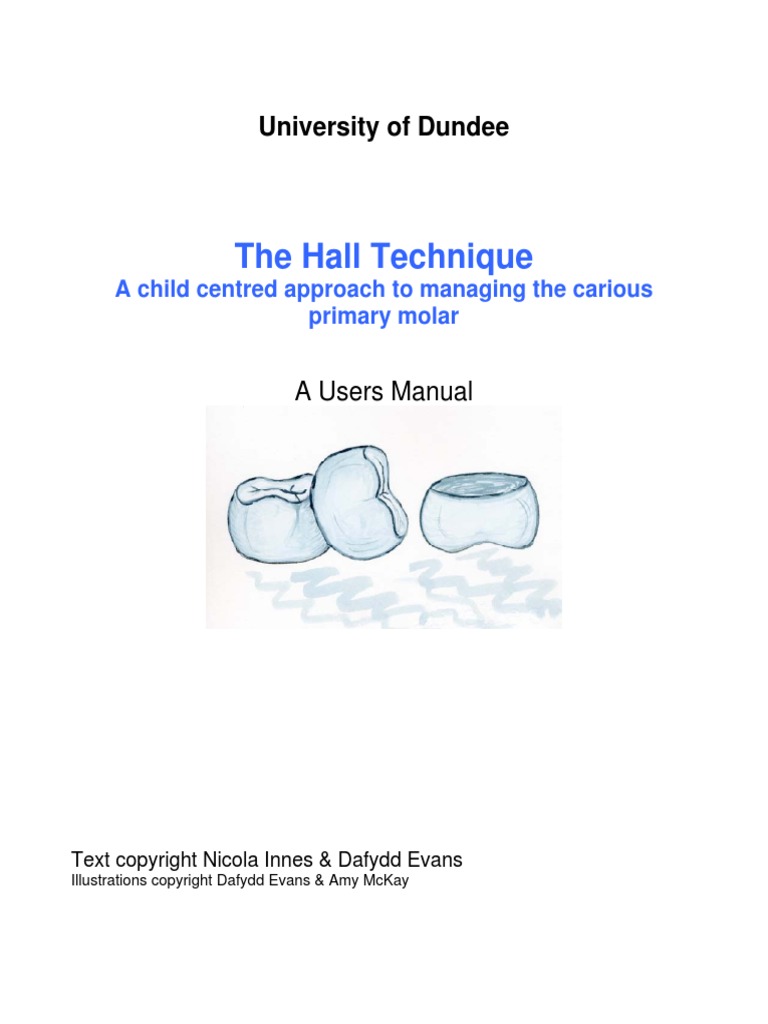NQVH The Hall Technique Manual | Download Free PDF | Health Care | Tooth