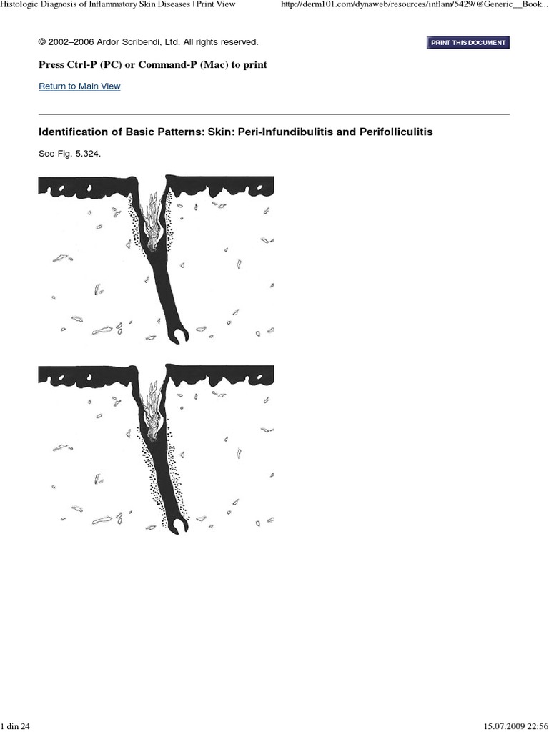 Identification of Basic Patterns - Skin - Peri-Infundibulitis and ...