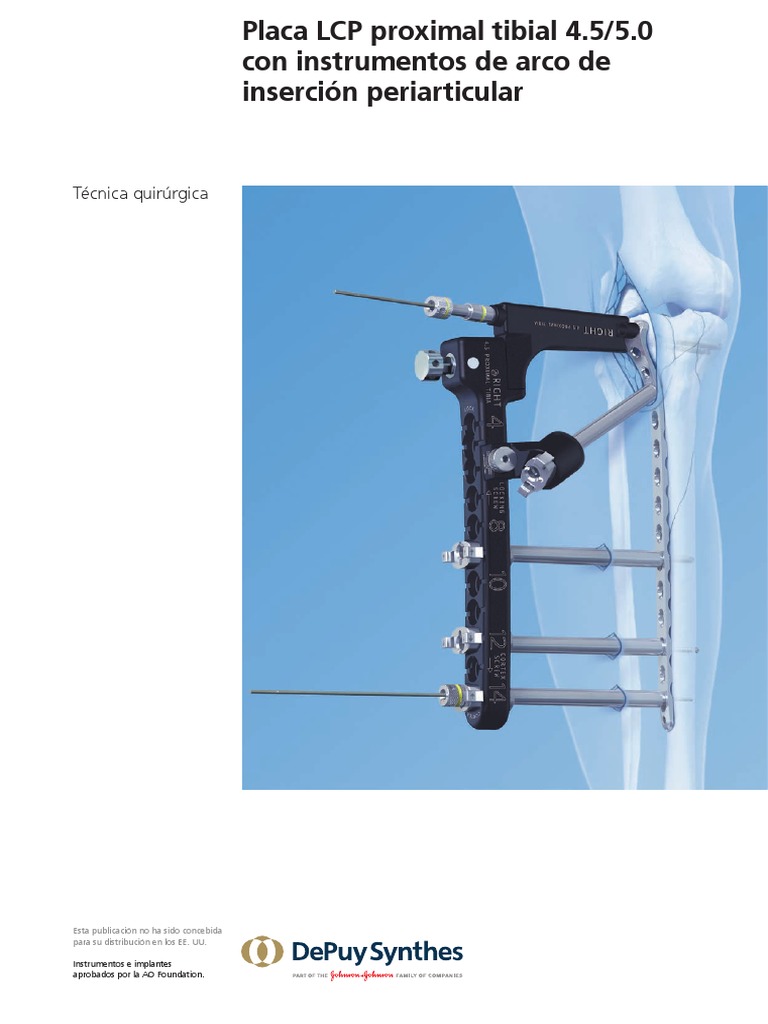 Placa LCP Proximal Tibial 4.5/5.0 Con Instrumentos de Arco de Inserción ...