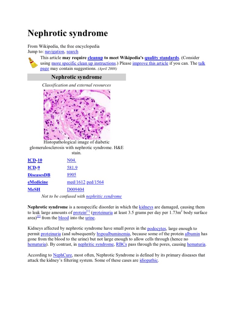 Nephrotic Syndrome | Edema | Kidney