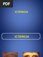 Causas de Ictericia: Pre, Hepática y Post | PDF | Hepatitis ...