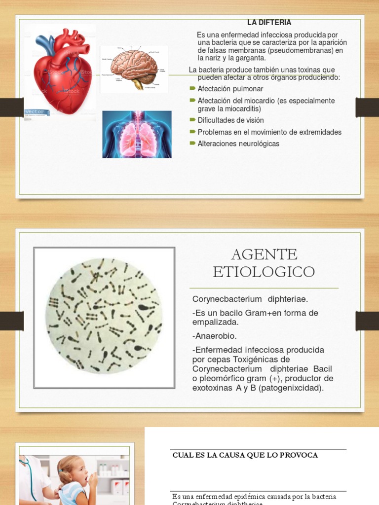 Difteria | PDF | Especialidades Medicas | Ciencias de la Salud