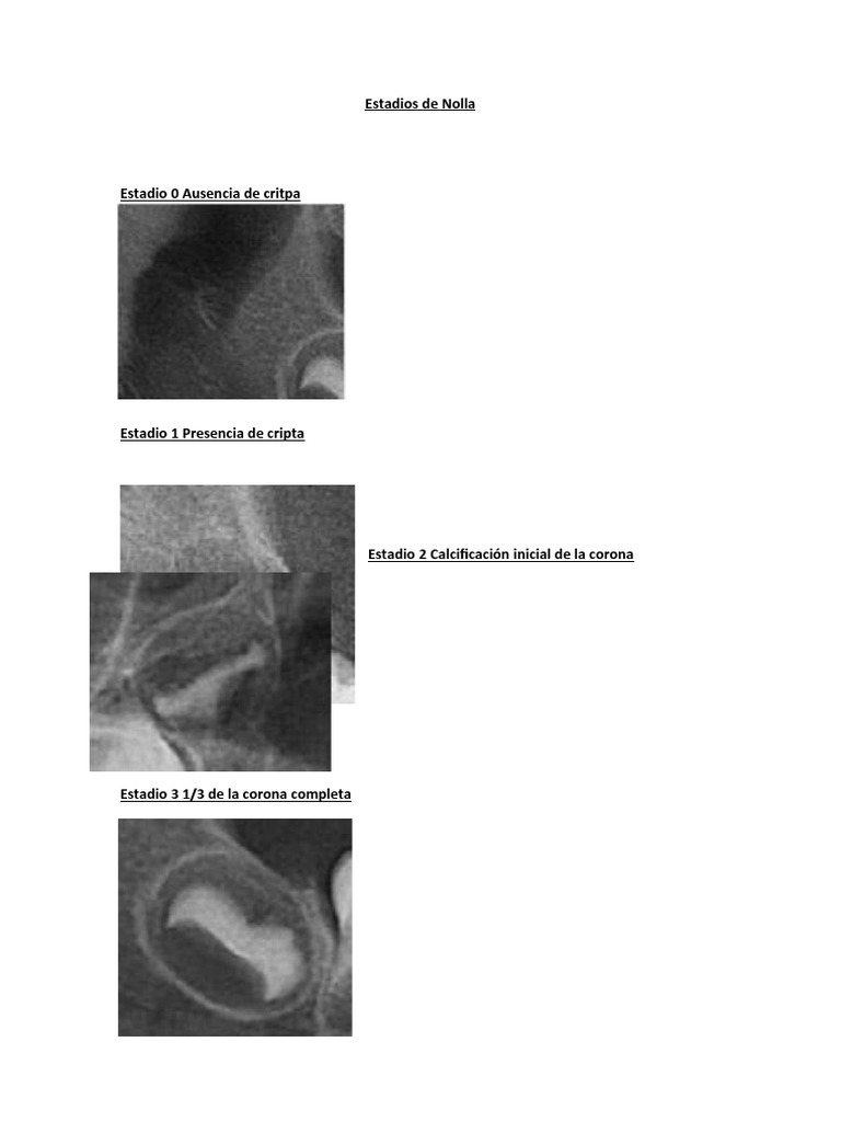 Etapas de Nolla | PDF | Cocina, comidas y vino