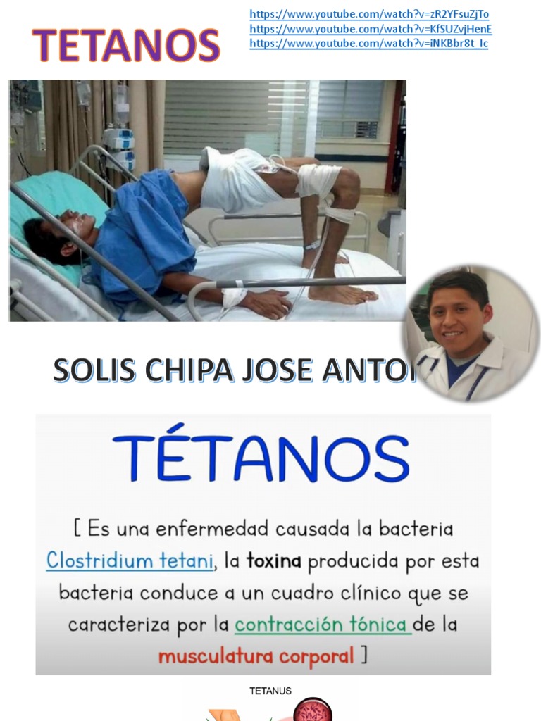 TETANOS | PDF